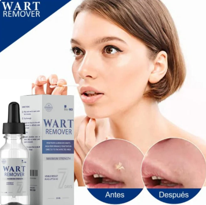 WART REMOVER | REMOVEDOR DE VERRUGAS Y LUNARES – Magic Peru Shop
